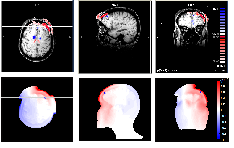 tDCS + Monitoring Solutions – Transcranial Direct Current Stimulation ...