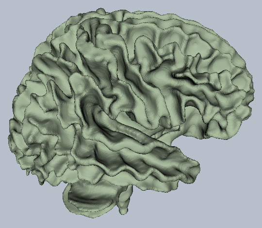 Neurotargeting Software – Soterix Medical