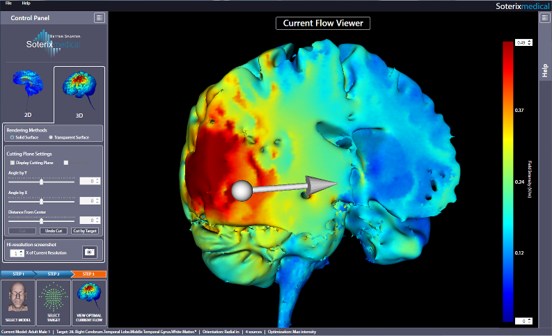 Products - 4×1 HD-tDCS Adaptor – Soterix Medical