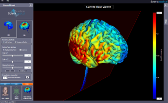 Neurotargeting Software HD-Targets – Soterix Medical