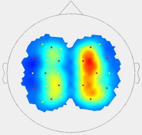 tDCS/tES + fNIRS – transcranial Electrical Stimulation + functional ...