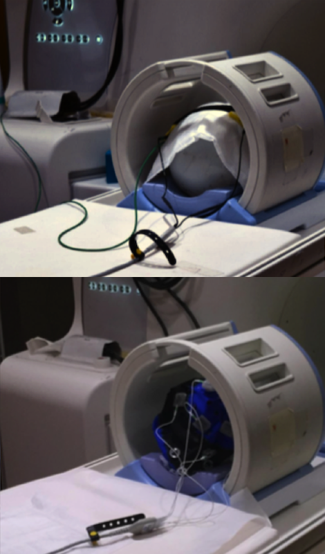 tES & fMRI – Soterix Medical